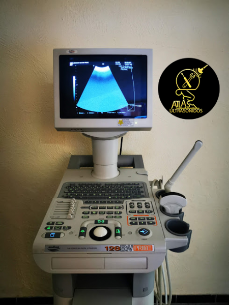 Ultrasonido Medison Sonoace 8000 Live – Atlas Ultrasonidos.